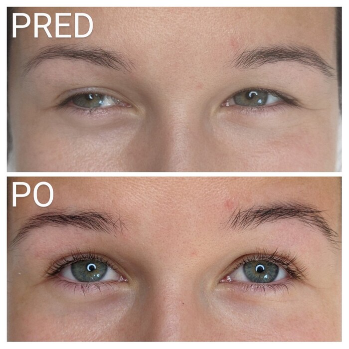 Lash Lifting – Prirodzené vytočenie mihalníc